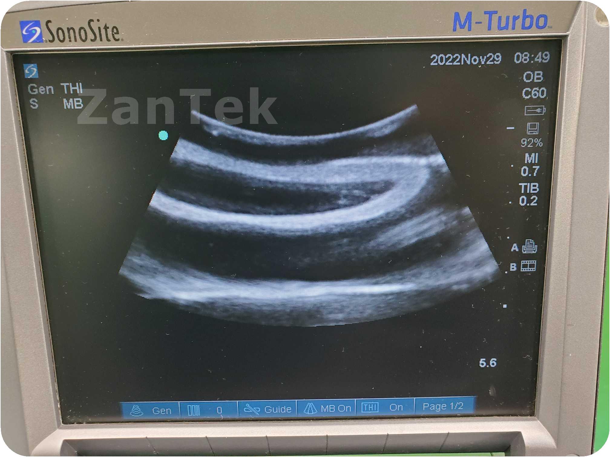 Zantek Medical - 312647-SonoSite C60x Ultrasound Transducer Probe