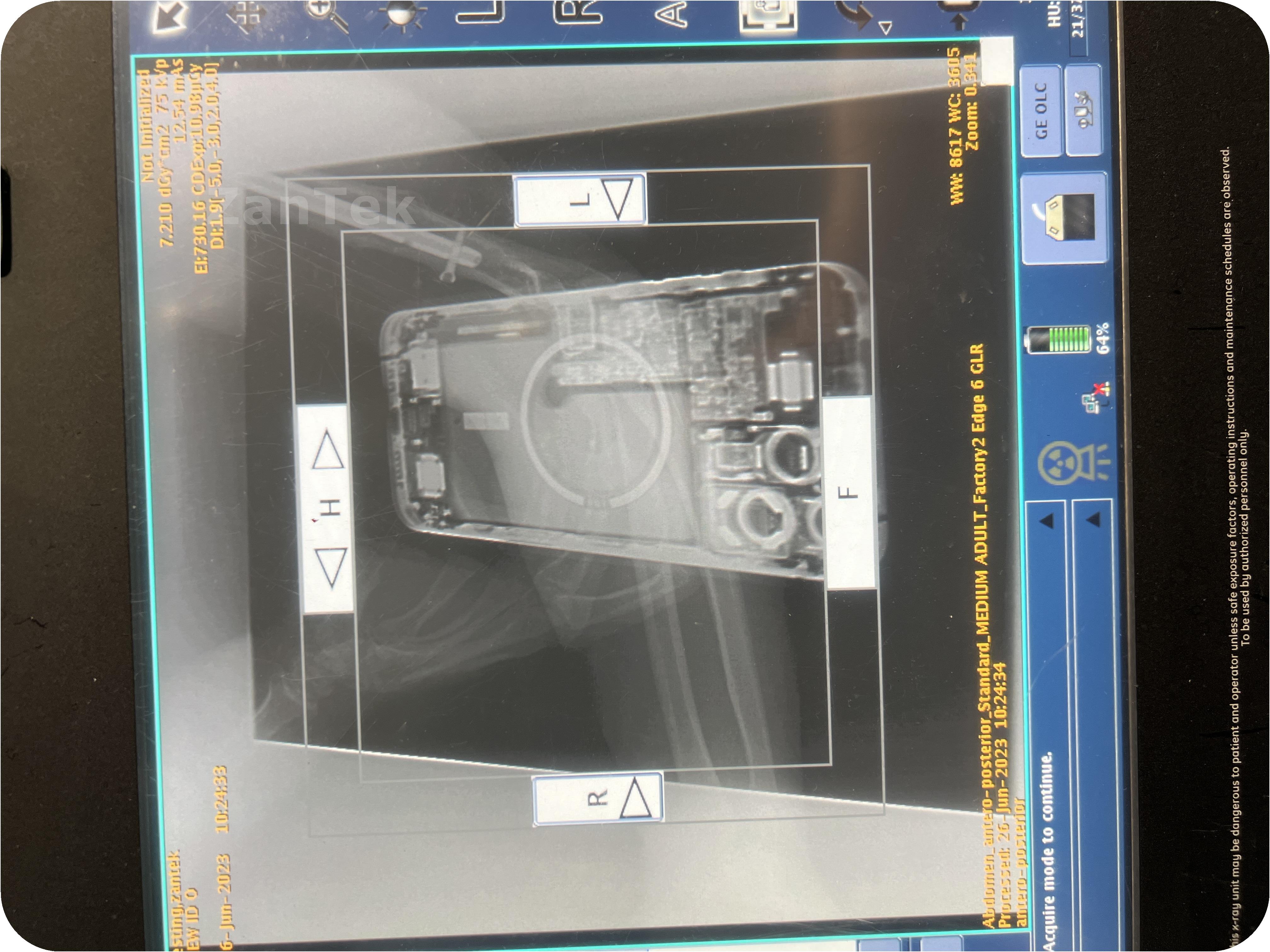Zantek Medical - 314599-GE Optima XR220 Digital Portable X-Ray Machine