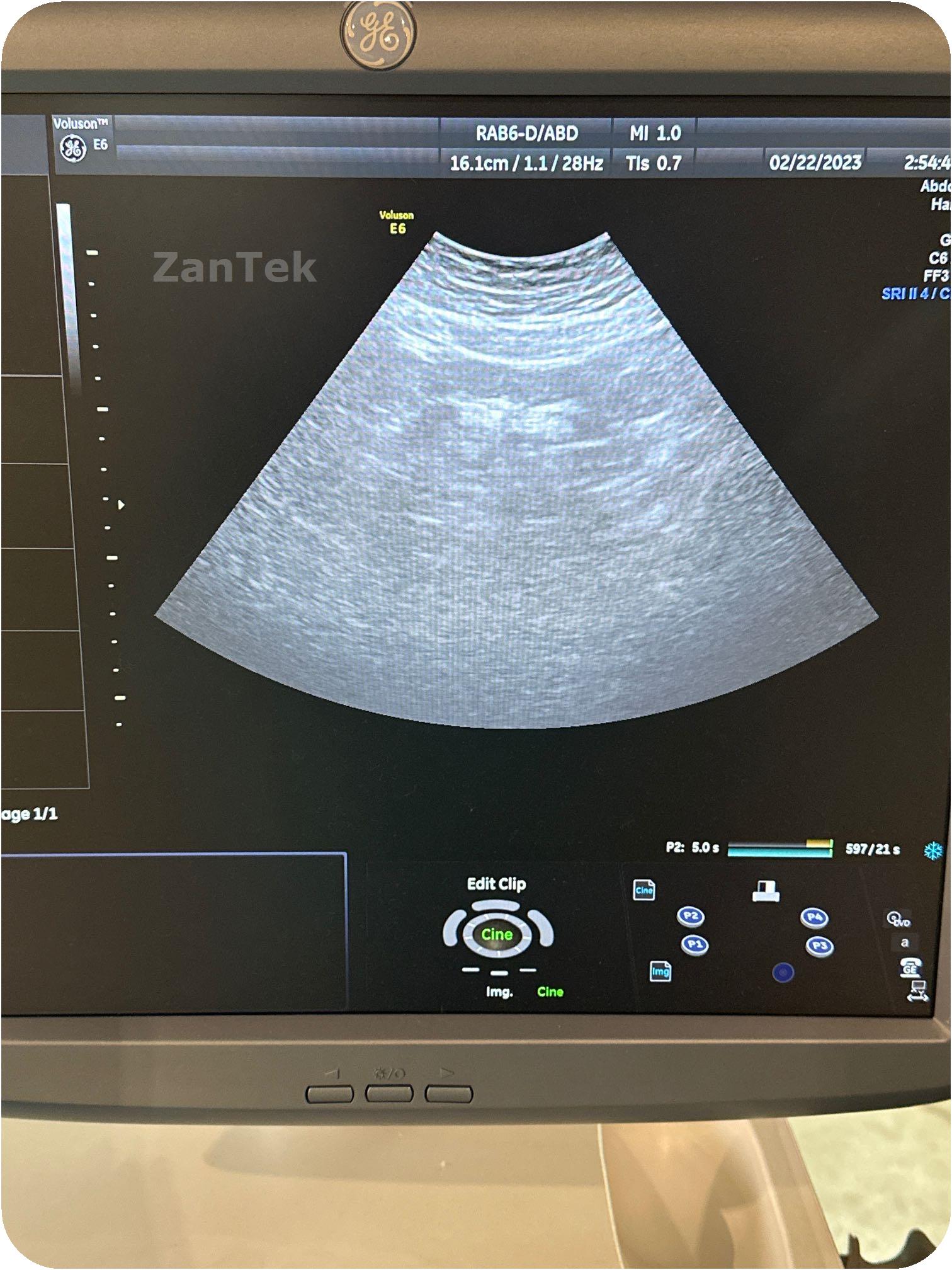 Zantek Medical - 321071-GE RAB6-D Ultrasound Transducer Probe