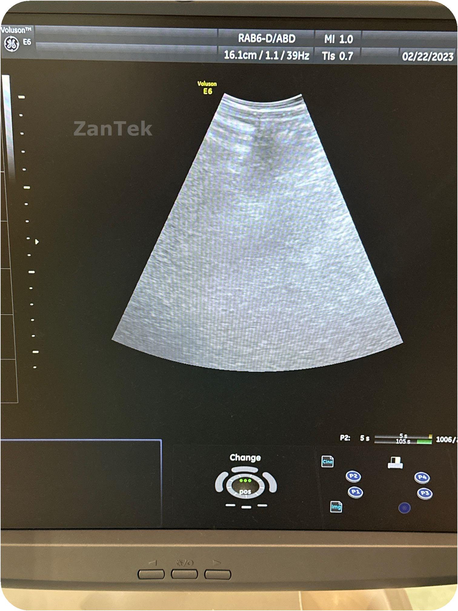 Zantek Medical - 321071-GE RAB6-D Ultrasound Transducer Probe