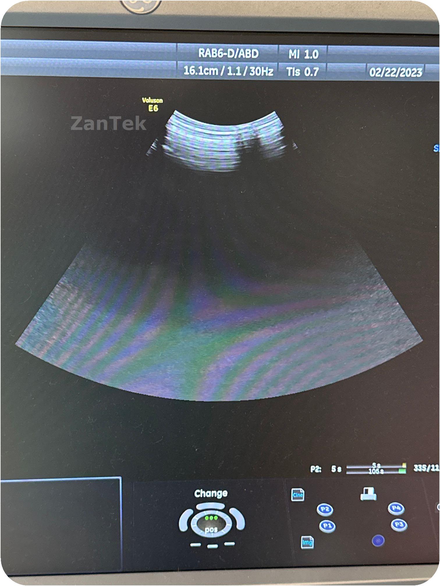 Zantek Medical - 321075-GE RAB6-D Ultrasound Transducer Probe