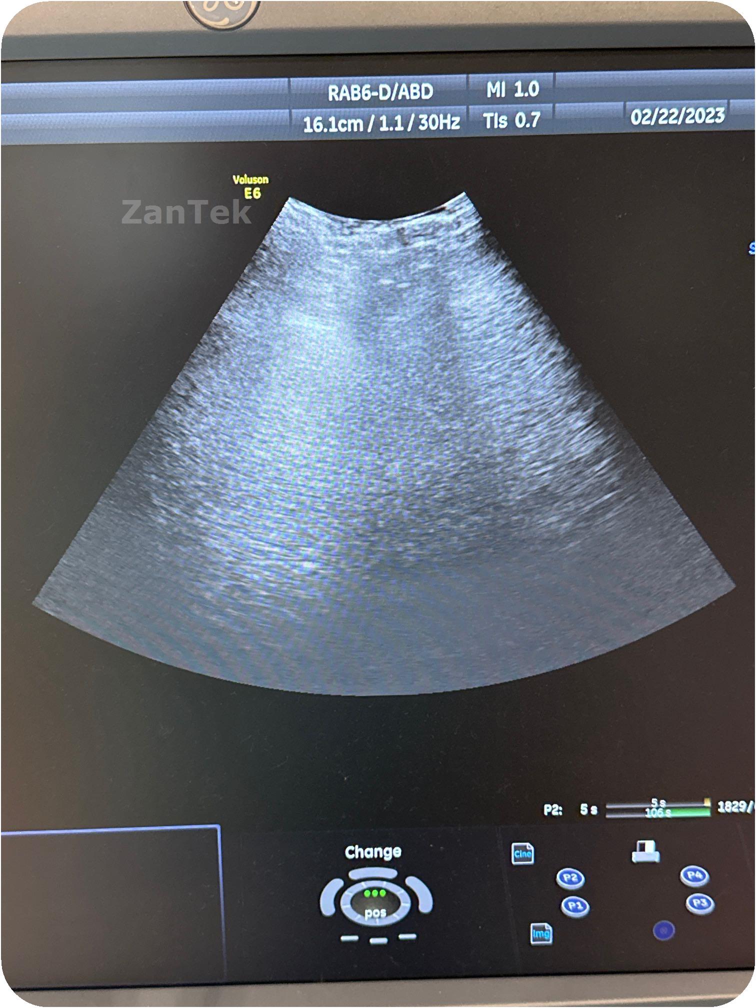Zantek Medical - 321075-GE RAB6-D Ultrasound Transducer Probe