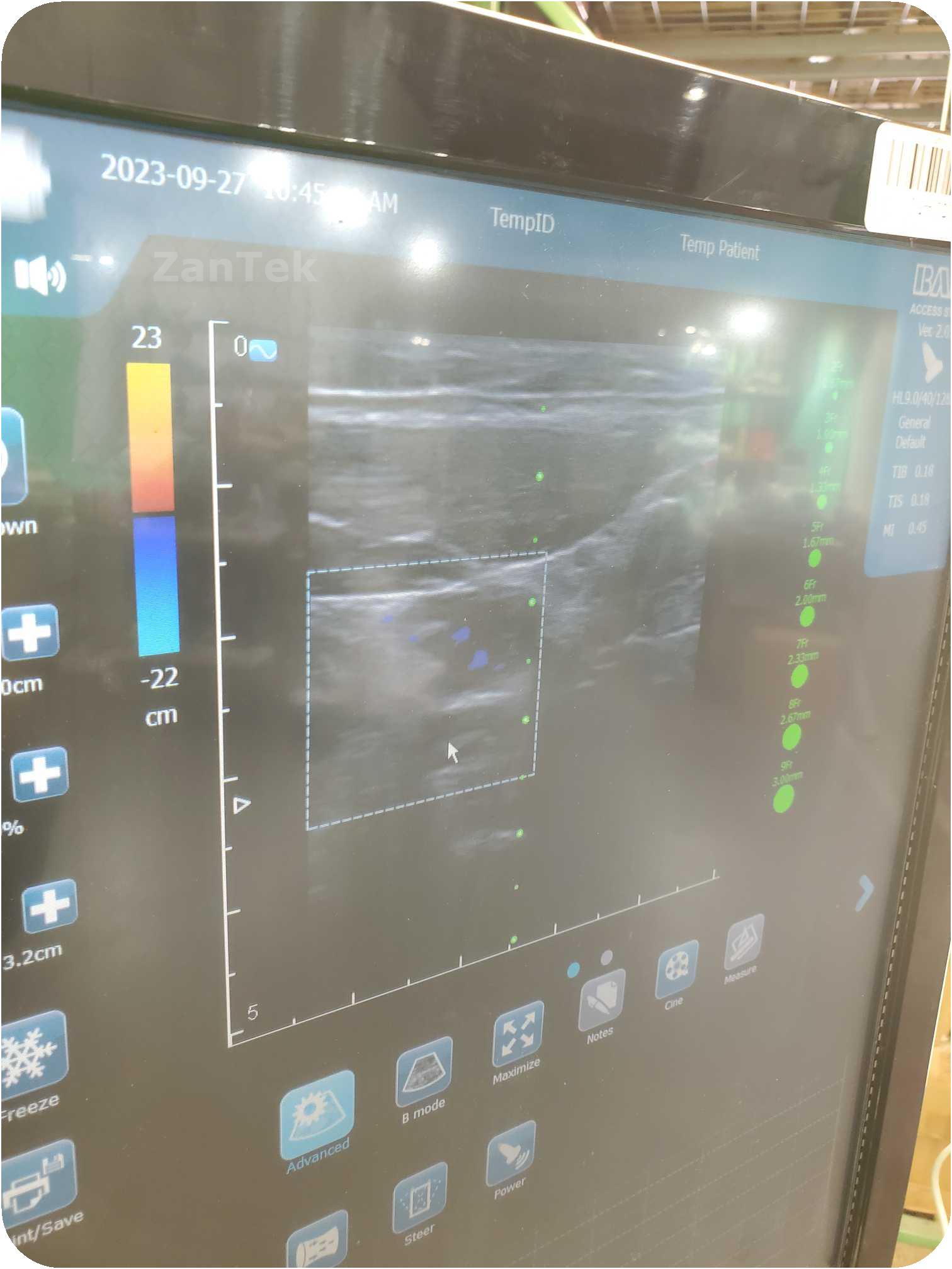 Zantek Medical - 323253-Bard Site Rite Vision II Ultrasound System