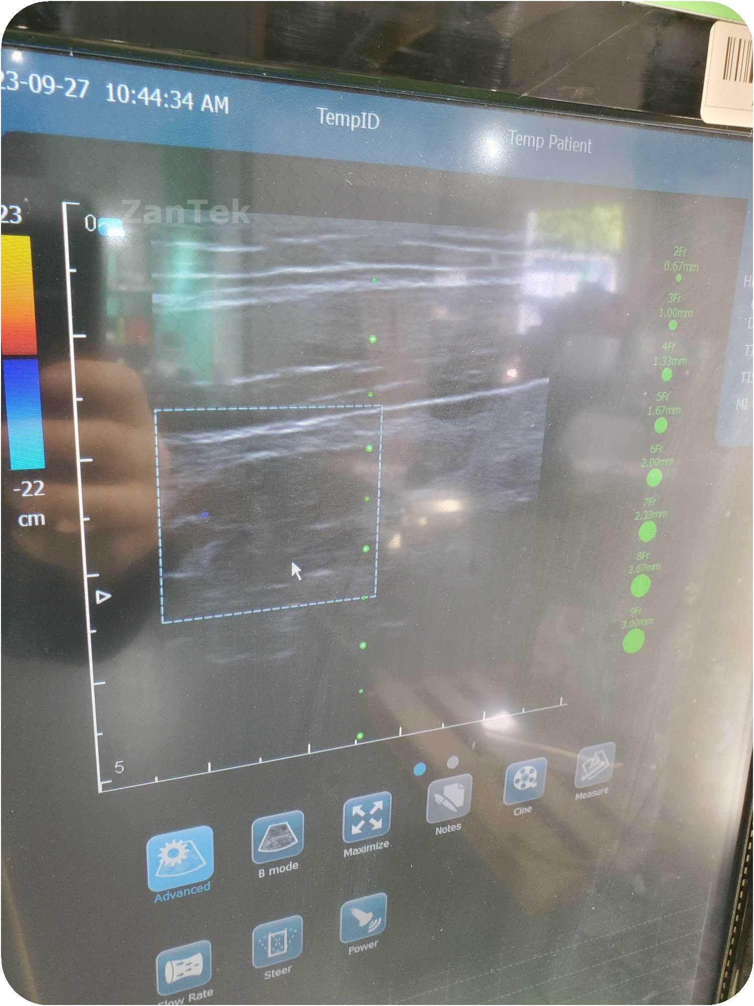 Zantek Medical - 323253-Bard Site Rite Vision II Ultrasound System