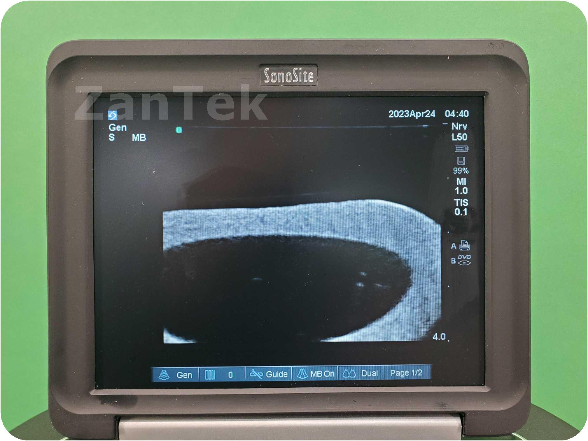 Zantek Medical - 325603-Sonosite Edge Ultrasound System
