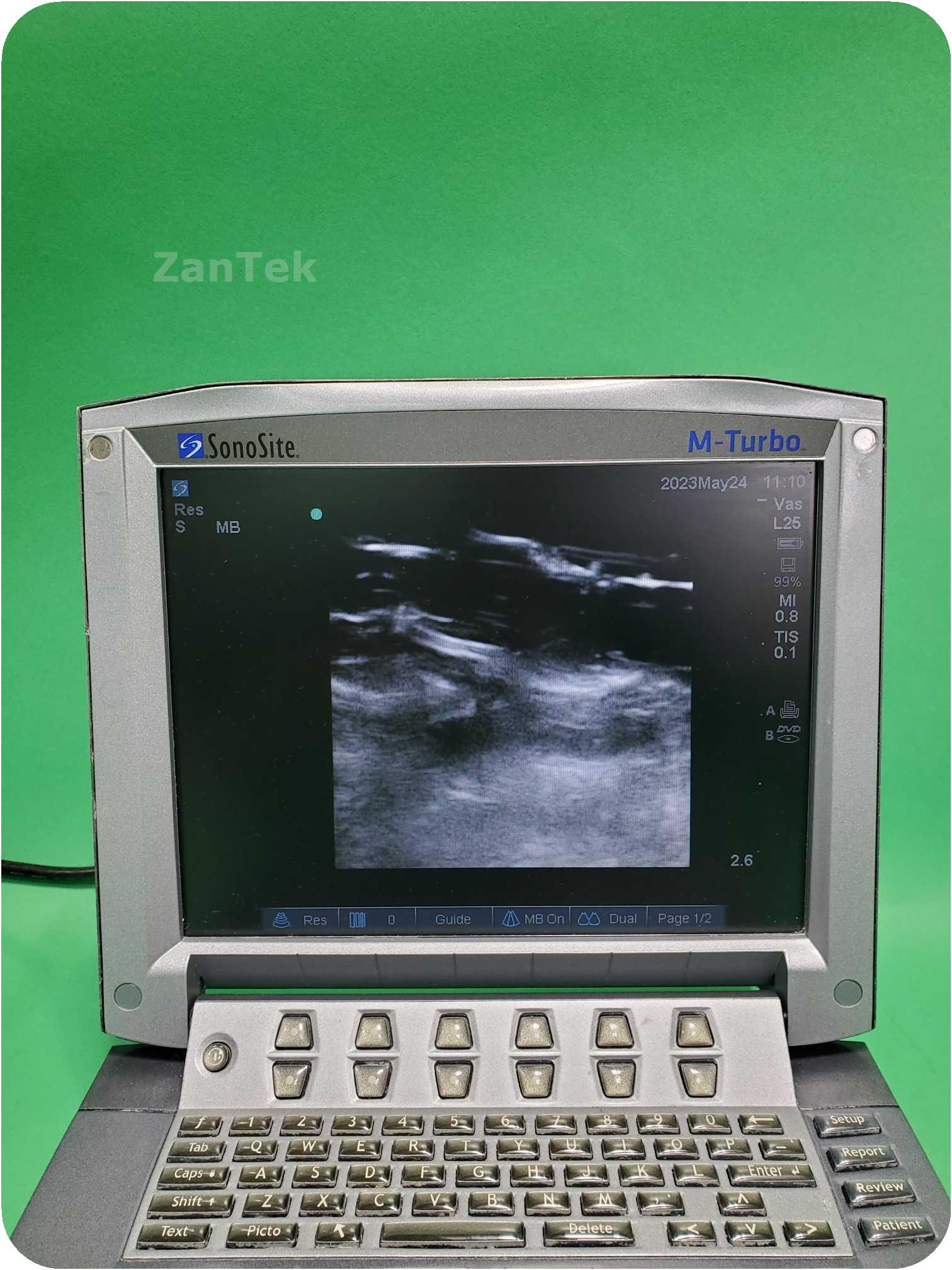 Zantek Medical - 325660-Sonosite M-Turbo Ultrasound System