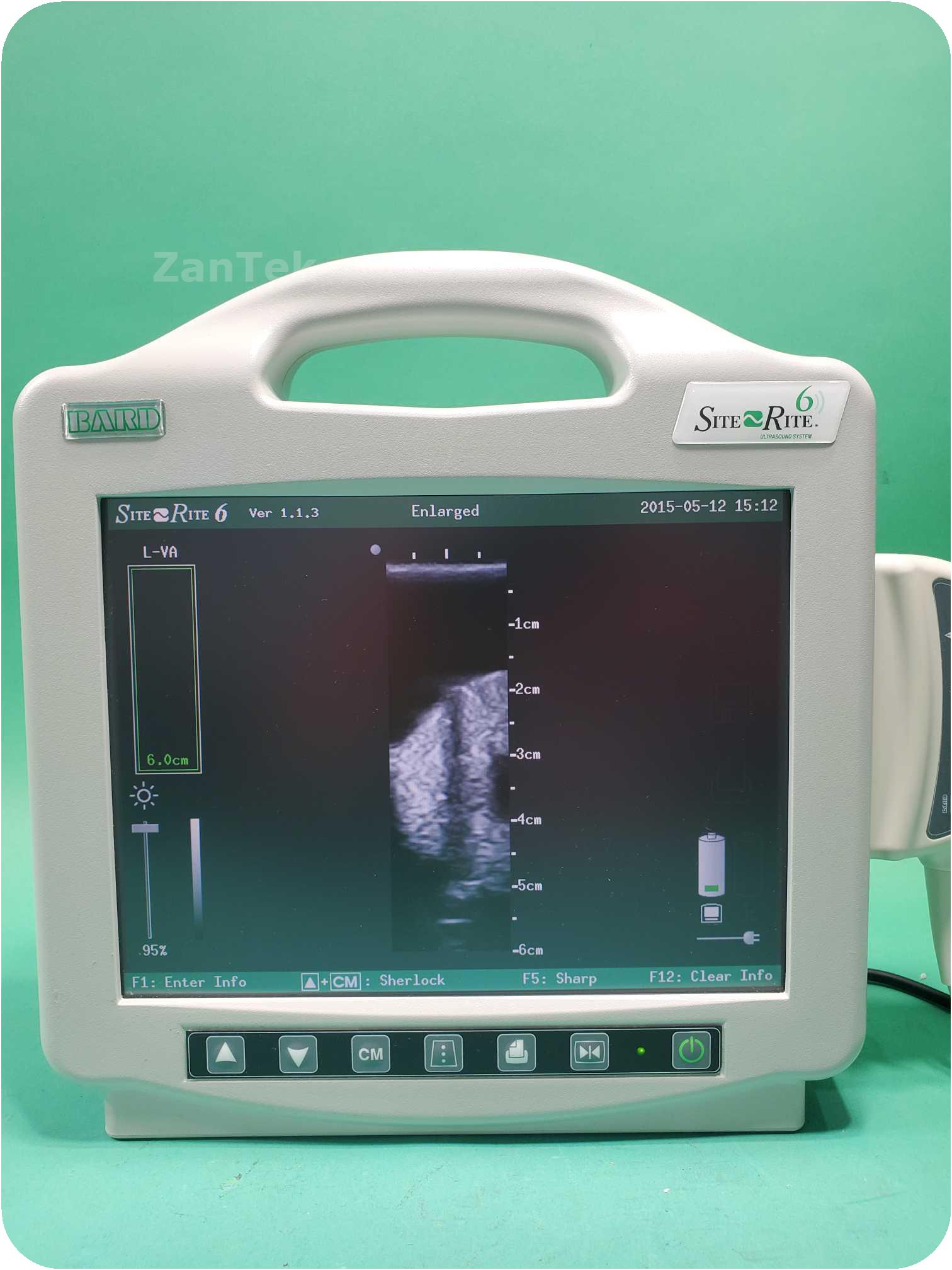 Zantek Medical - 327244-Bard Site Rite 6 9770066 Vascular Ultrasound
