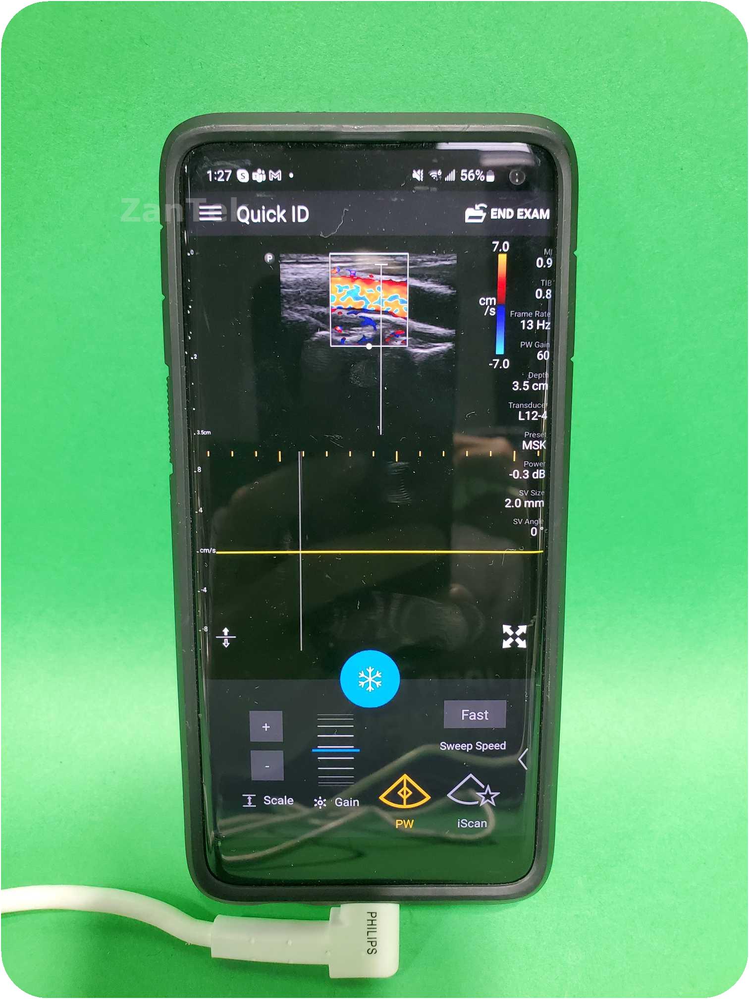 Zantek Medical - 345151-Philips Lumify L12-4 linear Ultrasound ...