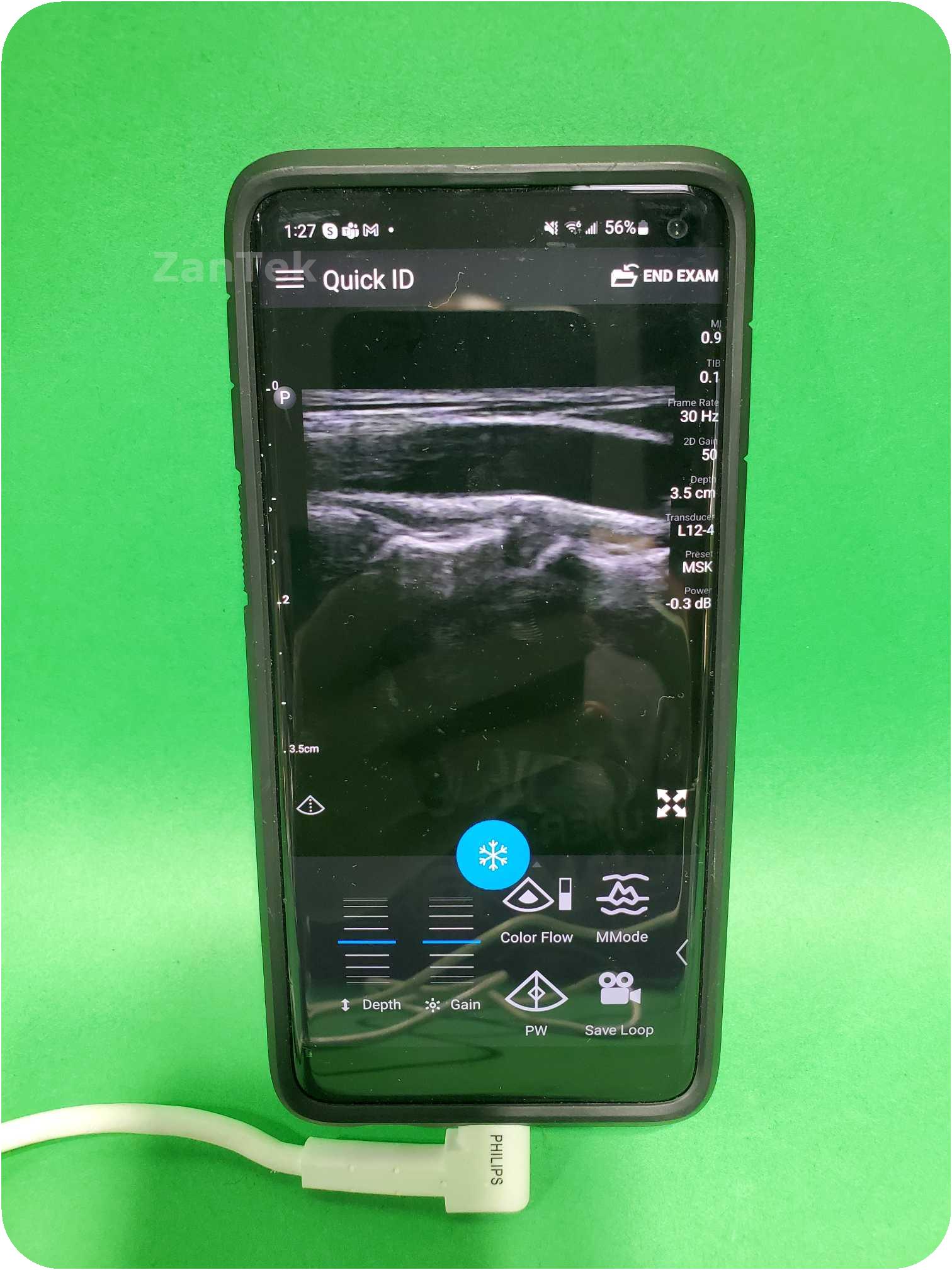 Zantek Medical - 345151-Philips Lumify L12-4 linear Ultrasound ...