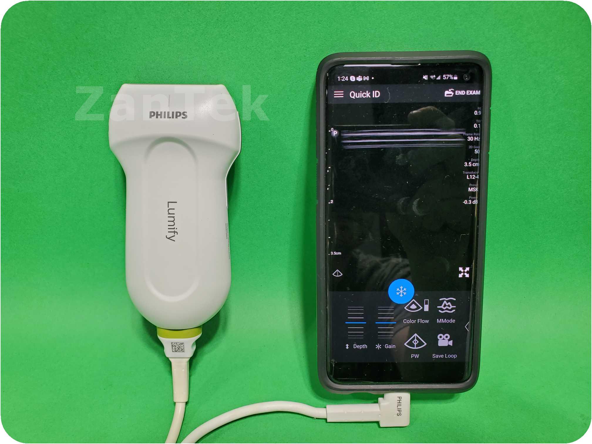 Zantek Medical - 345151-Philips Lumify L12-4 linear Ultrasound ...