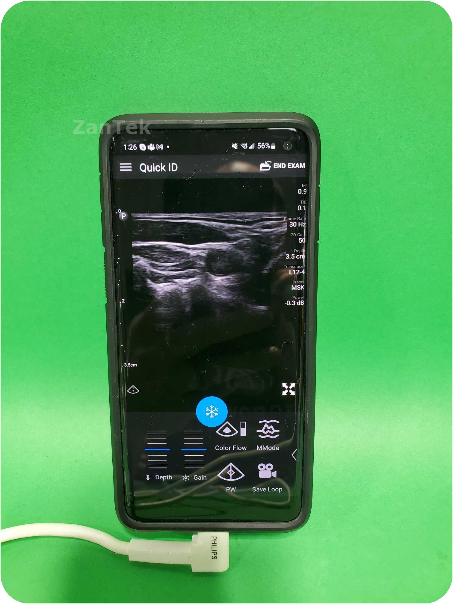 Zantek Medical - 345151-Philips Lumify L12-4 linear Ultrasound ...